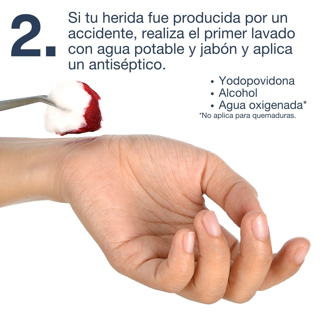 ¿Cómo hacer una curación correctamente? - Andrea Salamanca
